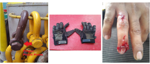 Finger injury during maintenance work - restricted work case – IMCA